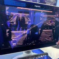 China Philipph Epiq 5 Ultrasound System Used in Good Condition Medical Equipment for sale