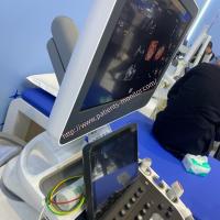 China Philipph EPIQ CVx Transcend Premium AI Cardiovascular Dedicated Ultrasound System for sale