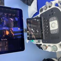 China Philipph Epiq7 Ultrasound System used in good working for hospital medical device for sale