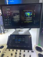 China VINNO ULTIMUS 9E Super Ultrasound Diagnostic System Used with Good Medical Device for sale