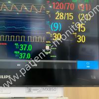 China PHiliph IntelliVue MX850 Patient Monitor Modular Machine Multiparameter Medical Equipment for sale
