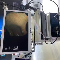 China VINNO Vicyto-6000 pro medical endoscope image processor medical equipment for sale