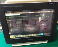 China RESP NIBP SPO2 Intellivue Mx450 Patient Monitor Repair Hospital Use for sale