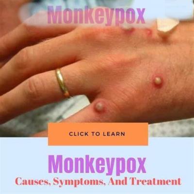 China CE Certified Monkeypox RT-PCR Assay Test Kit for Accurate Viral Detection 48 Tests for sale
