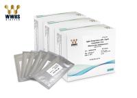 China AFP Tumor Marker Rapid Quantitative Test Kit Fluorescence Immunoassay for sale