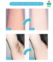 China Tear-Resistant Non-Woven Epilating Roll for Body and Facial Hair Removal for sale
