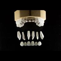 China Feldspathic Porcelain Dental Veneer Layered Zirconia Fabrication for sale