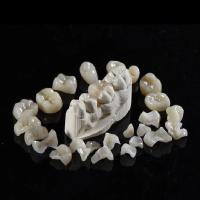 China Tooth All Porcelain IPS Emax Inlay Onlay Veneer Aesthetic In Dentistry for sale