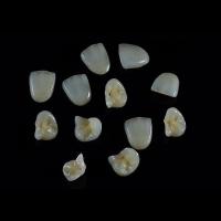 China Tooth All Porcelain IPS Emax Inlay Onlay Veneer Aesthetic In Dentistry for sale