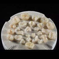 China Tooth All Porcelain IPS Emax Inlay Onlay Veneer Aesthetic In Dentistry for sale