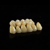 China Biocompatible Zirconia Ceramic Dental Crown Tooth Restorations Custom for sale