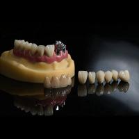 China Porcelain Ceramic PFM Dental Crown Material For Restoration for sale