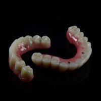 China CAD CAM Milled Teeth Temporary Dental Implant Prosthesis Crown Bridge for sale