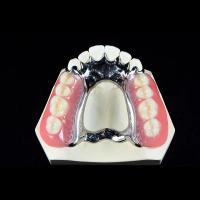 China Premium Full Metal Frame Denture Co Cr Framework Cobalt Chromium Alloy for sale