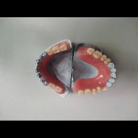 China Removable Lower Upper Partial Acrylic Denture For Missing Teeth for sale