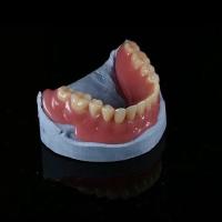 China Removable Full Acrylic Denture Teeth Restoring Customized Fit for sale