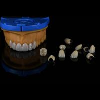 China Dentists Cad Cam PFM Crown Ceramic Material Metal Foundation for sale