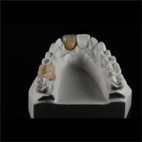 China Dentists Cad Cam PFM Crown Ceramic Material Metal Foundation for sale
