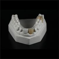 China Dentists Cad Cam PFM Crown Ceramic Material Metal Foundation for sale