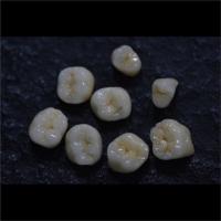 China Dentists Cad Cam PFM Crown Ceramic Material Metal Foundation for sale
