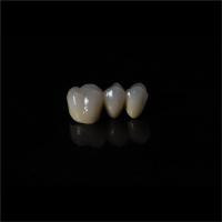 China Anti Wear Implant PFM Dental Bridge Prosthesis Teeth Replacement for sale