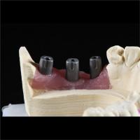 China Cad Cam Implant PFM Crown Bridge Dental Medical Grade Adhesive for sale