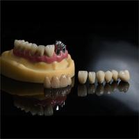 China Cad Cam Implant PFM Crown Bridge Dental Medical Grade Adhesive for sale