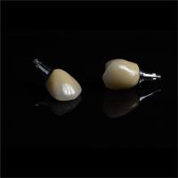 China Cad Cam Implant PFM Crown Bridge Dental Medical Grade Adhesive for sale