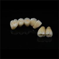 China Cad Cam Implant PFM Crown Bridge Dental Medical Grade Adhesive for sale