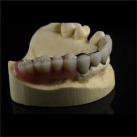 China Precision Zirconia PFM Crowns Partial Dentures Natural Looking for sale