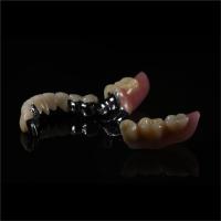China Precision Zirconia PFM Crowns Partial Dentures Natural Looking for sale