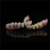 China Precision Zirconia PFM Crowns Partial Dentures Natural Looking for sale
