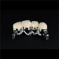 China Precision Zirconia PFM Crowns Partial Dentures Natural Looking for sale