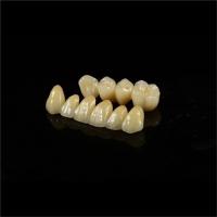 China Personalized Strong Ceramic Zirconia Dental Crown Full Mouth Full Contour for sale