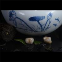 China Personalized Strong Ceramic Zirconia Dental Crown Full Mouth Full Contour for sale