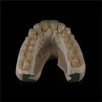 China Personalized Strong Ceramic Zirconia Dental Crown Full Mouth Full Contour for sale