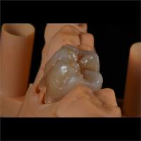 China Personalized Strong Ceramic Zirconia Dental Crown Full Mouth Full Contour for sale