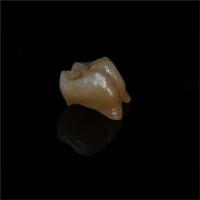 China Personalized Strong Ceramic Zirconia Dental Crown Full Mouth Full Contour for sale