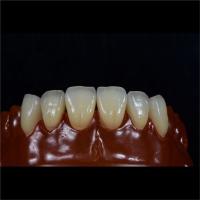China Tooth Multi Layered Zirconia Crown for Restorative Dentistry for sale