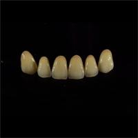 China Tooth Multi Layered Zirconia Crown for Restorative Dentistry for sale