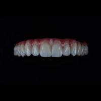 China Full Coutour Arch Zirconia Fixed Dentures Crown Biocompatible Material for sale