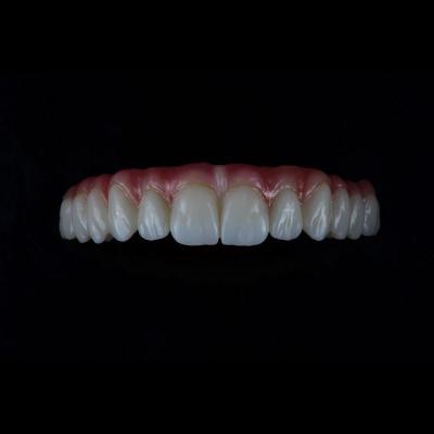 China Full Coutour Arch Zirconia Fixed Dentures Crown Biocompatible Material for sale
