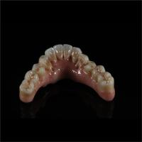 China Full Coutour Arch Zirconia Fixed Dentures Crown Biocompatible Material for sale