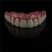 China Full Coutour Arch Zirconia Fixed Dentures Crown Biocompatible Material for sale