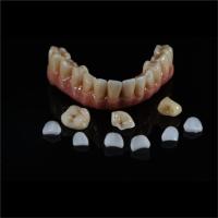 China Fixed Restorations Full Arch Zirconia Implant Bridge Denture Teeth for sale