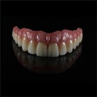China Fixed Restorations Full Arch Zirconia Implant Bridge Denture Teeth for sale