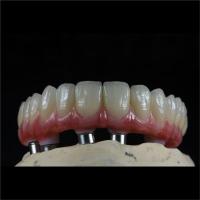 China Fixed Restorations Full Arch Zirconia Implant Bridge Denture Teeth for sale