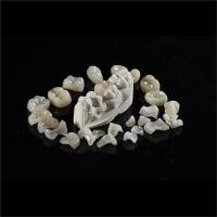 China Dental Restorations IPS EMax Inlay Onlay All Porcelain Highly Durable for sale