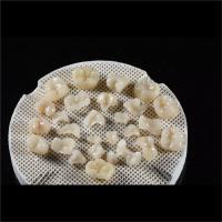 China Dental Restorations IPS EMax Inlay Onlay All Porcelain Highly Durable for sale