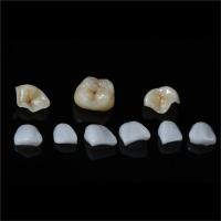 China Dental Restorations IPS EMax Inlay Onlay All Porcelain Highly Durable for sale